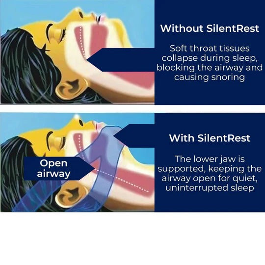 Full Head Chin Strap for Jaw Support During Sleep